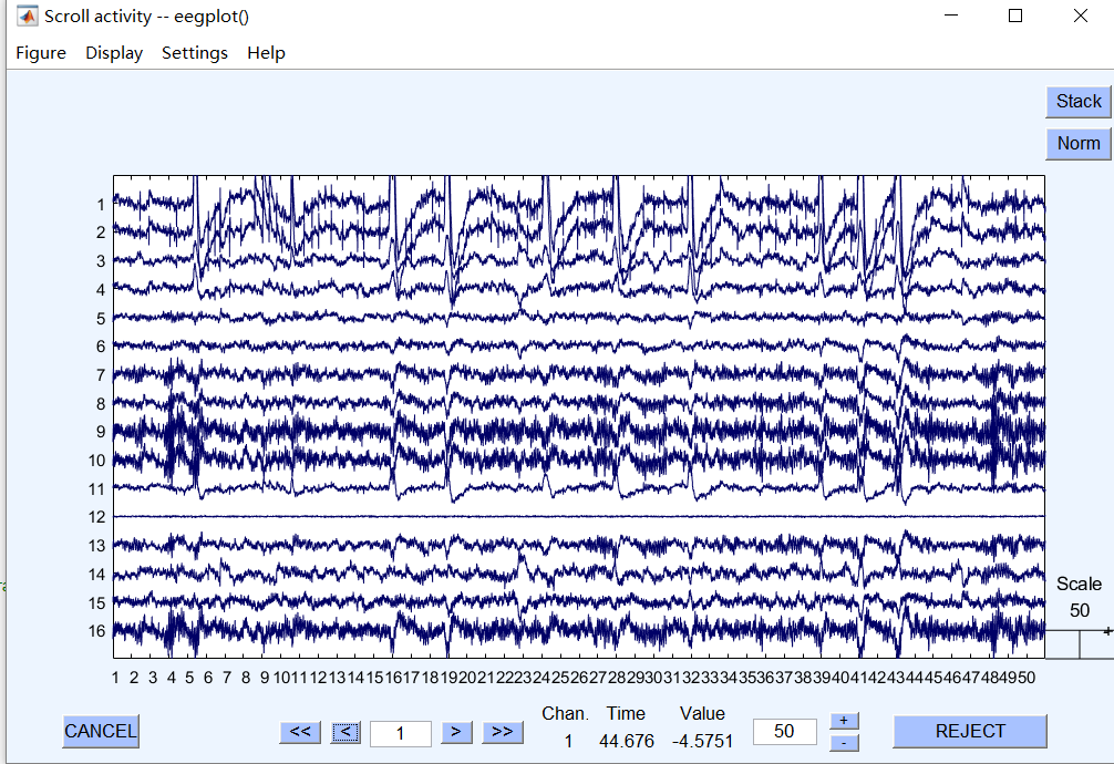 EEGLAB初步学习（1）_eeglab是哪年版本-CSDN博客