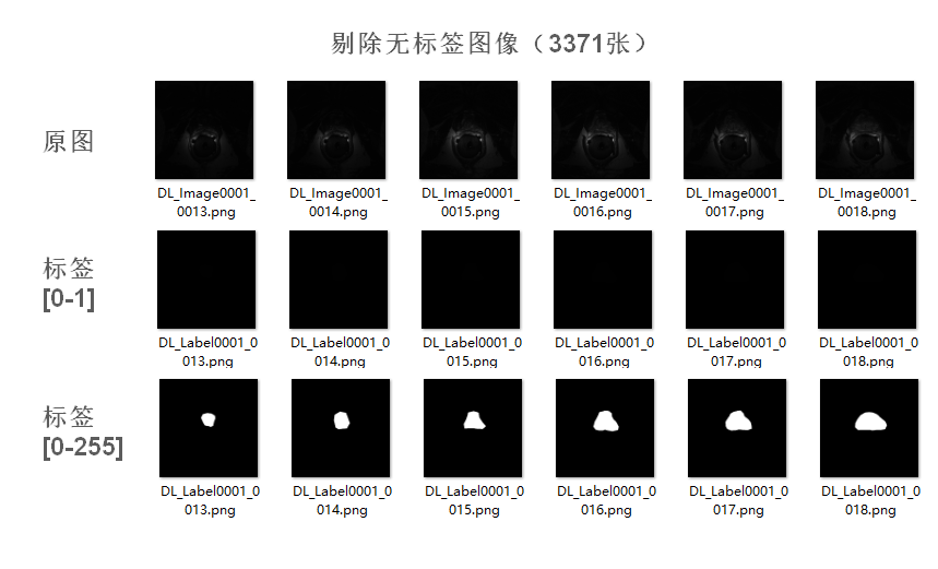 【实验记录】DSAC：Learning deep structured active contours end-to-end-CSDN博客