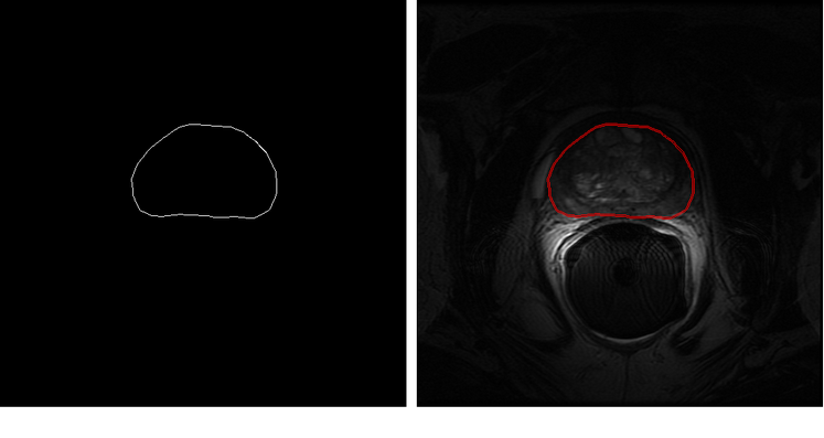 【实验记录】DSAC：Learning deep structured active contours end-to-end-CSDN博客