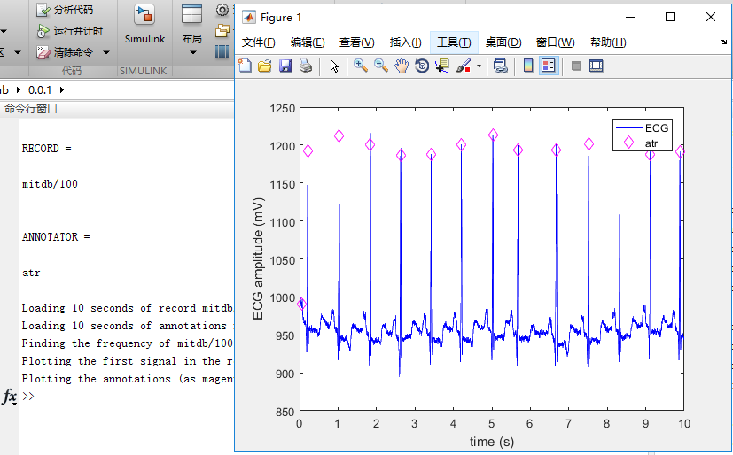 Matlab下wfdb的吐血安装_警告: your wfdb toolbox installation path contain wh-CSDN博客
