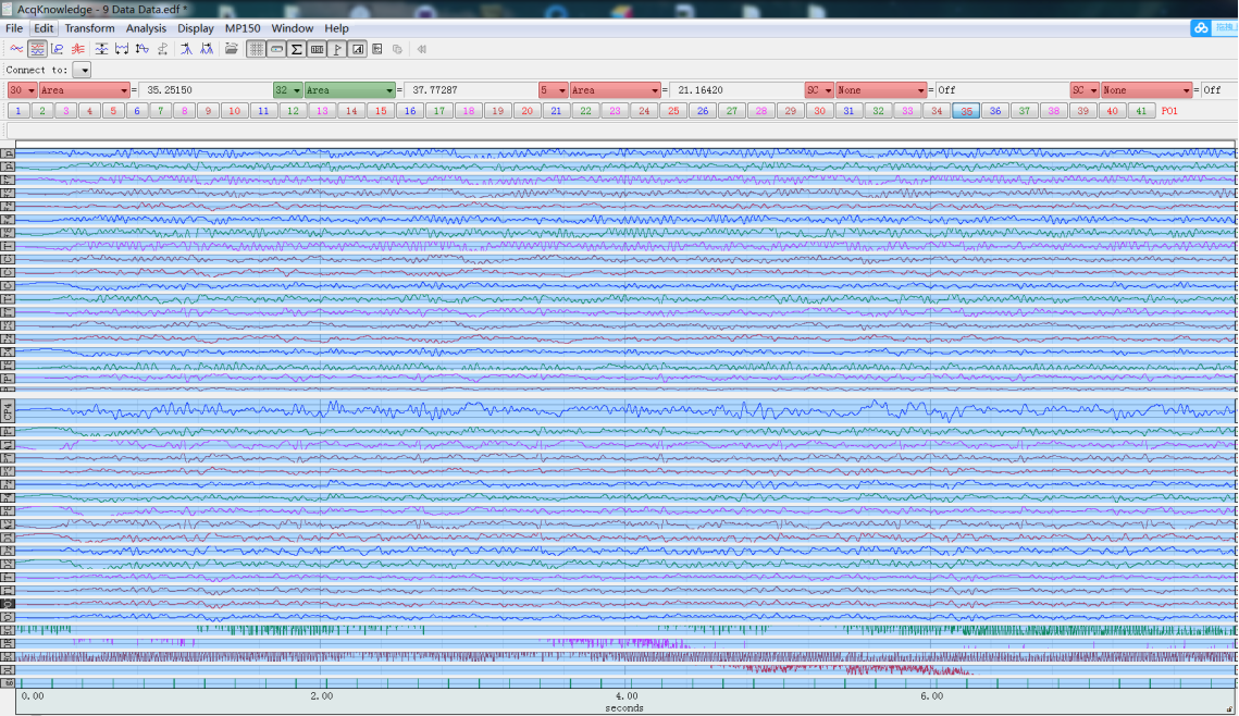 AcqKnowledge脑电数据分析处理记录-CSDN博客