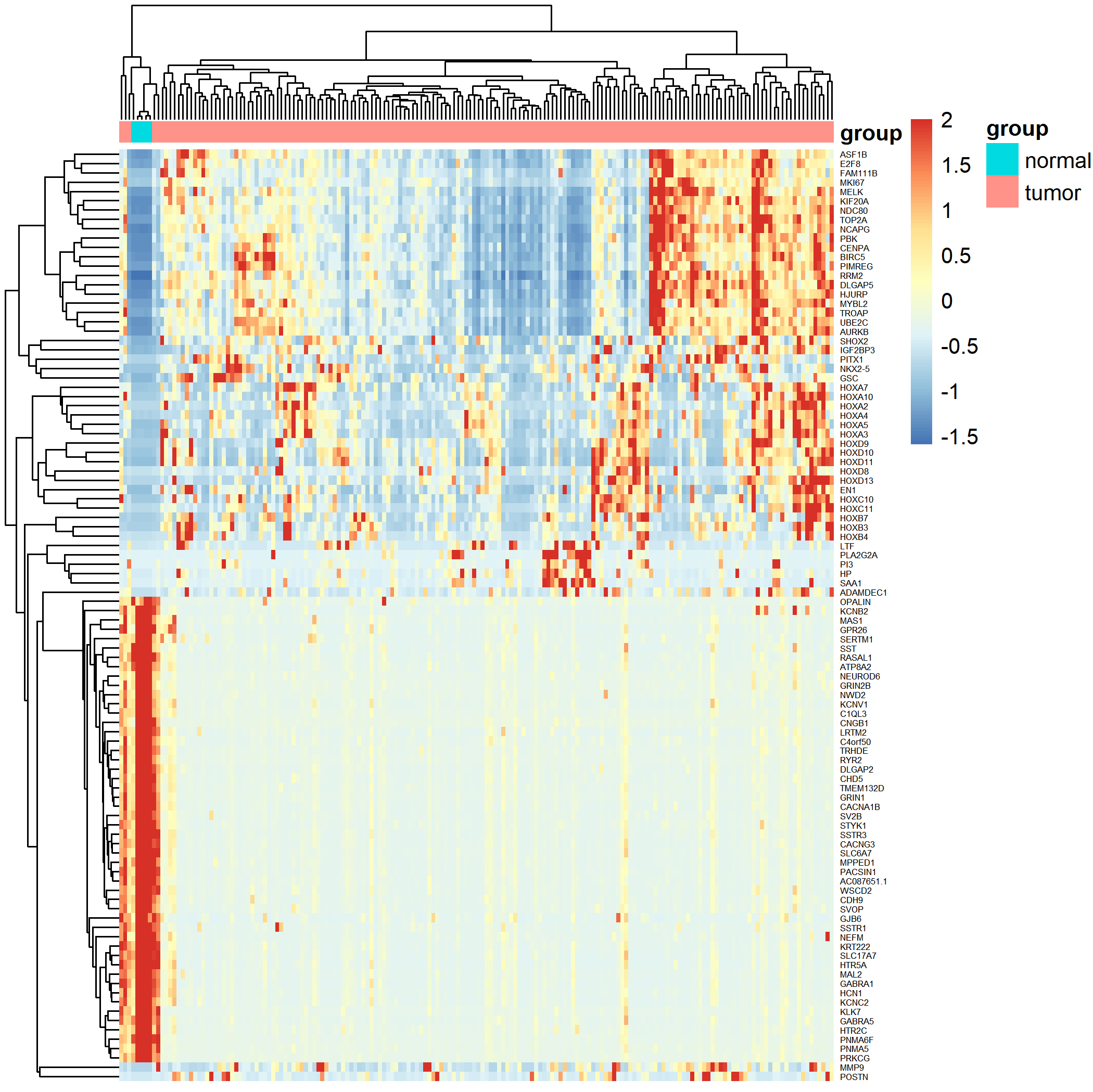 TCGA数据挖掘--神经胶质瘤（GBM）差异mRNA分析_tcga-gbm-CSDN博客