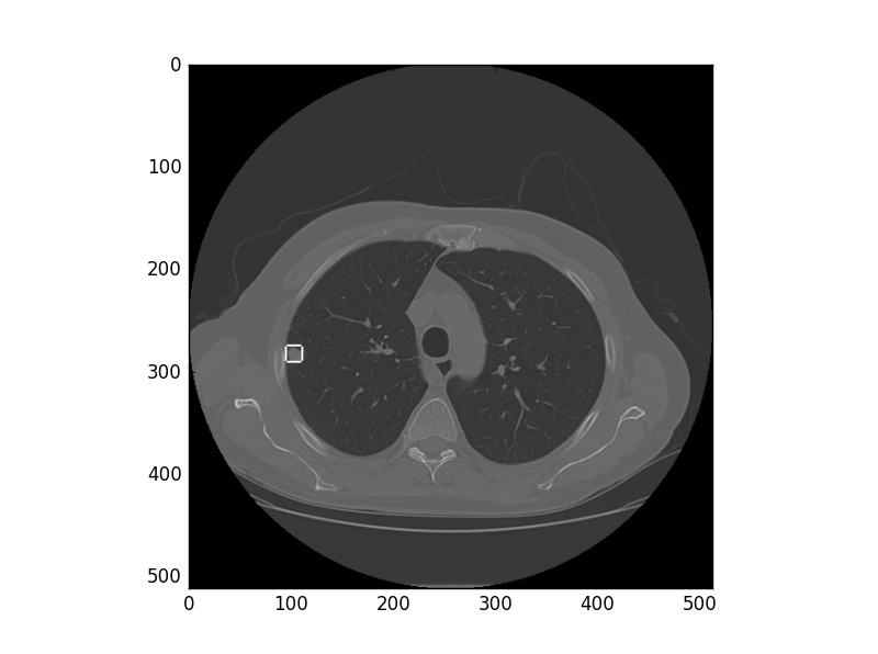 LUNA 2016 数据集详解_luna16数据集-CSDN博客