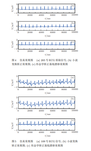 关于ECG信号的形态学滤波原理_ecg滤波算法-CSDN博客