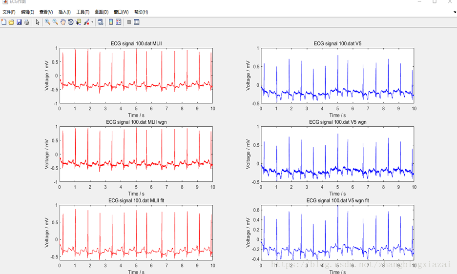 MIT-BIH数据库ECG心电图数据处理画图与心率计算（附详细注释）_mit-bih中的心电图数据-CSDN博客