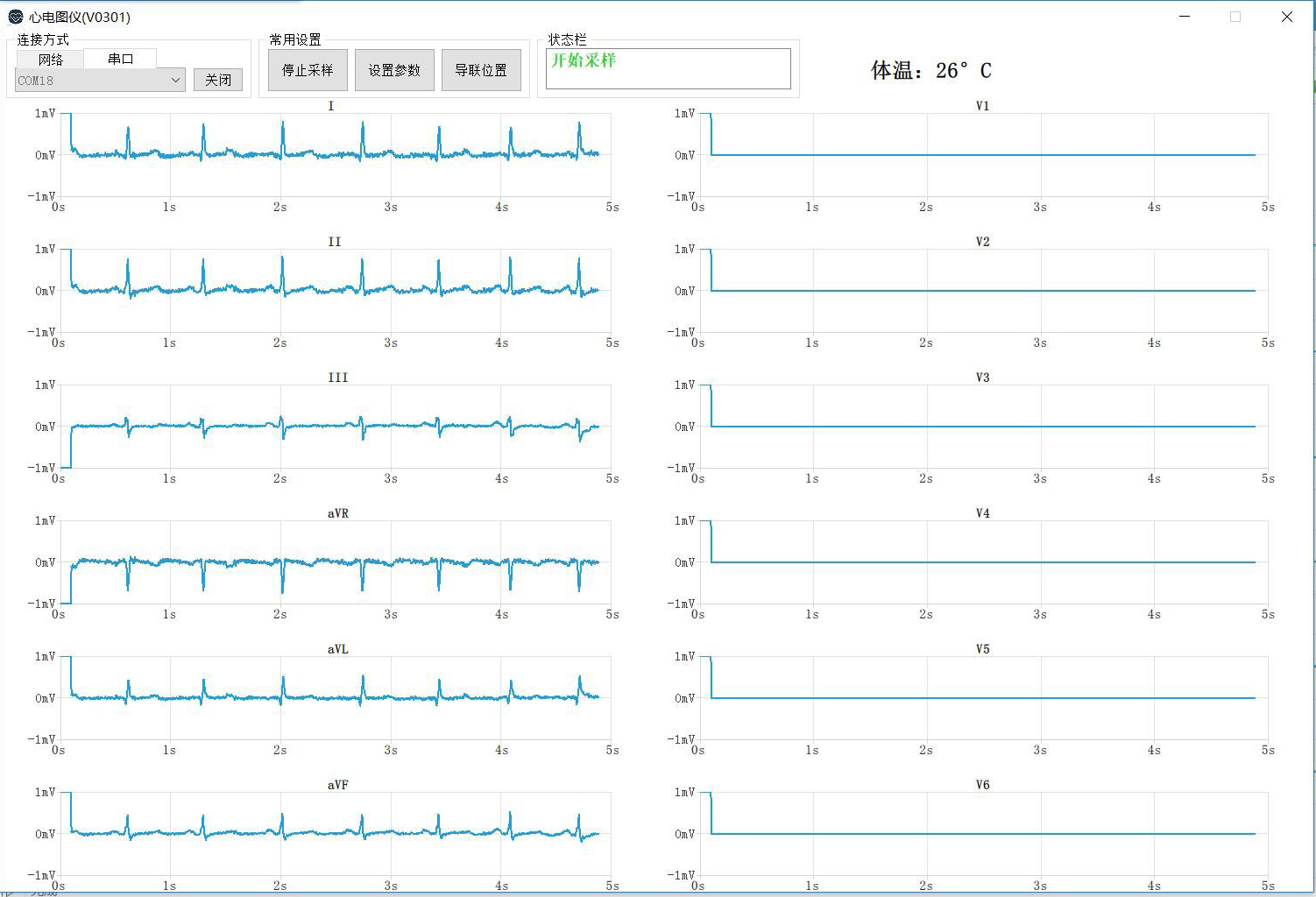 基于ADS1298的心电图仪-CSDN博客