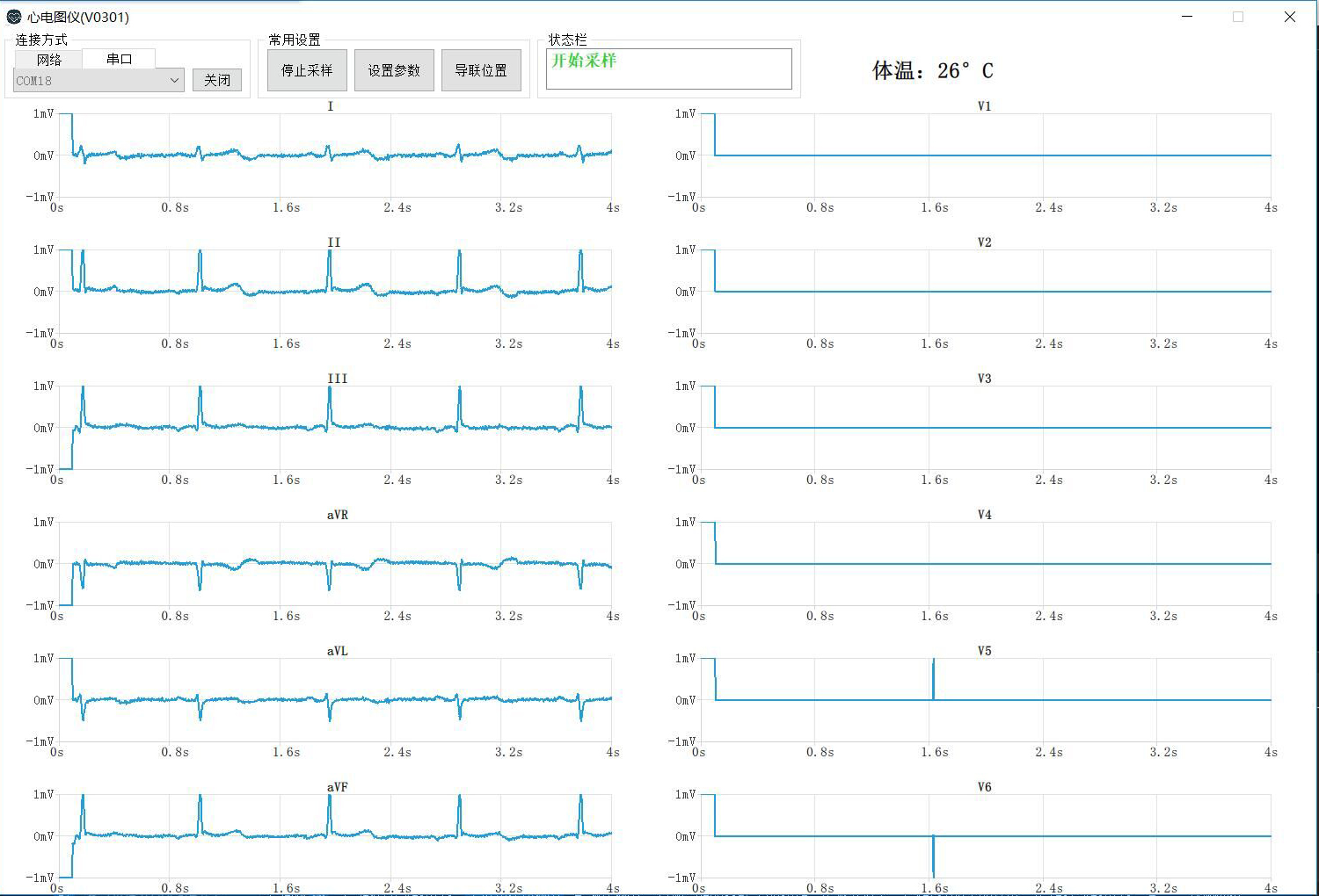 基于ADS1298的心电图仪-CSDN博客