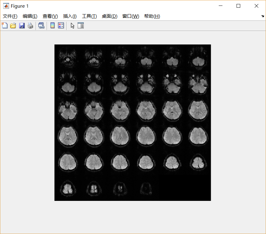使用matlab读取mri影像的dicom文件andheaderdicomread Dicominfo函数 Csdn博客 