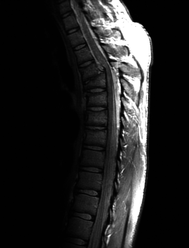 数字图像处理学习笔记（三）gamma变换（C++语言）_为什么1字节像素经过gamma转换后变成2字节-CSDN博客