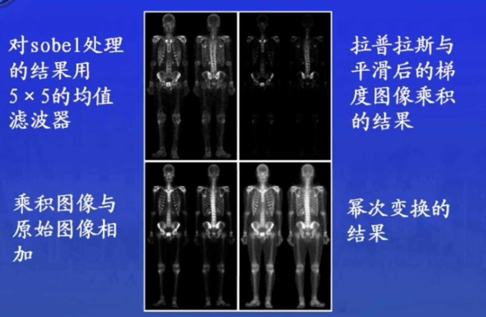 混合空间增强法opencv混合空间图像增强 Csdn博客