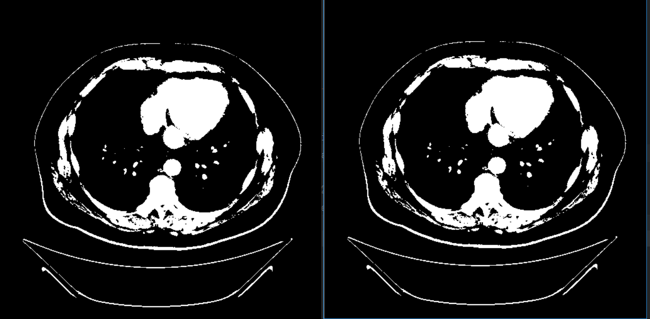 【随笔，NIFTI格式图像的读取后】_怎么看标注的nii的mask是二值图还是灰度图-CSDN博客
