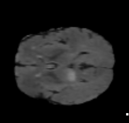 如何读取NIFTI格式图像（.nii文件）_nii格式nifti打不开-CSDN博客