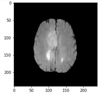 如何读取NIFTI格式图像（.nii文件）_nii格式nifti打不开-CSDN博客
