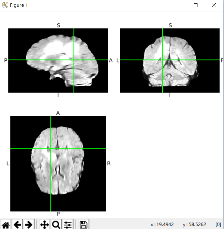 如何读取NIFTI格式图像（.nii文件）_nii格式nifti打不开-CSDN博客