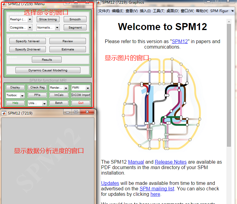 SPM12 核磁数据预处理 傻瓜攻略-CSDN博客