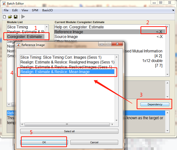 SPM12 核磁数据预处理 傻瓜攻略-CSDN博客