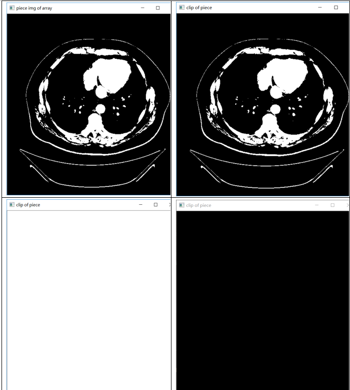 【CT值与灰度值的总结】_ct值和灰度值关系-CSDN博客