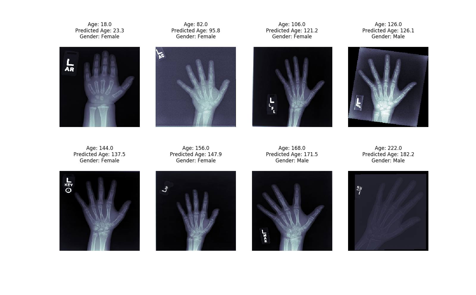 【蓝蜗牛】骨龄检测（一）_kaggle上有x光片预测骨龄-CSDN博客