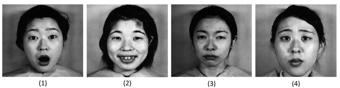 FER基于卷积神经网络: 处理少量数据和训练样本订单FER with CNN:Coping with few data and the training sample order_jaffe ...