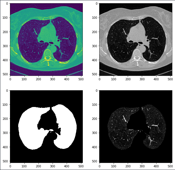 实战：使用yolov3完成肺结节检测（Luna16数据集）及肺实质分割_luna16目标检测-CSDN博客