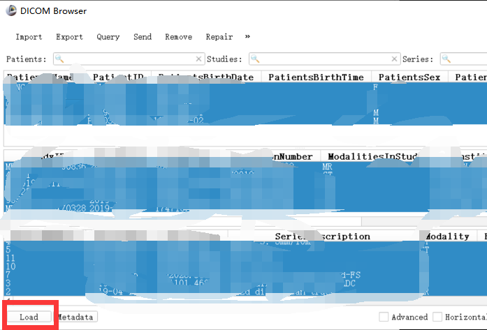 3D Slicer 把dicom数据转换成numpy_3dslicer获取 numpy-CSDN博客