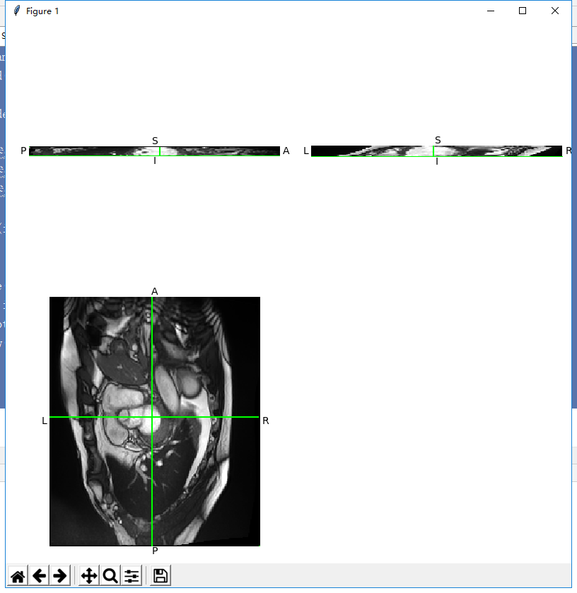 python读取.nii.gz文件并展示医学图片_gz文件如何可视化-CSDN博客