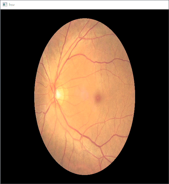 眼底图像预处理-图像亮度增强_ytkml2016的博客-CSDN博客_眼底图像增强