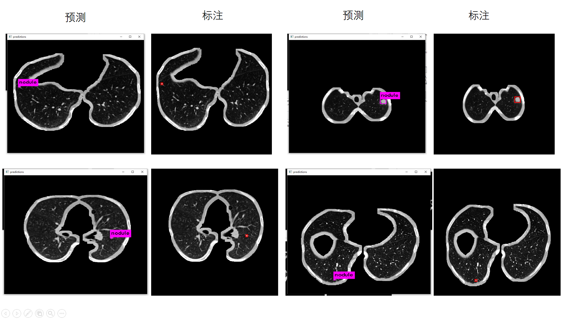 实战：使用yolov3完成肺结节检测（Luna16数据集）及肺实质分割_luna16目标检测-CSDN博客