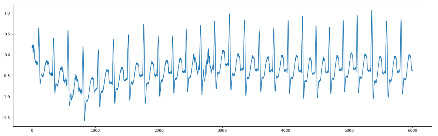 MIT-BIH心率失常数据的读取以及简单处理_mit-hib心率数据预处理-CSDN博客