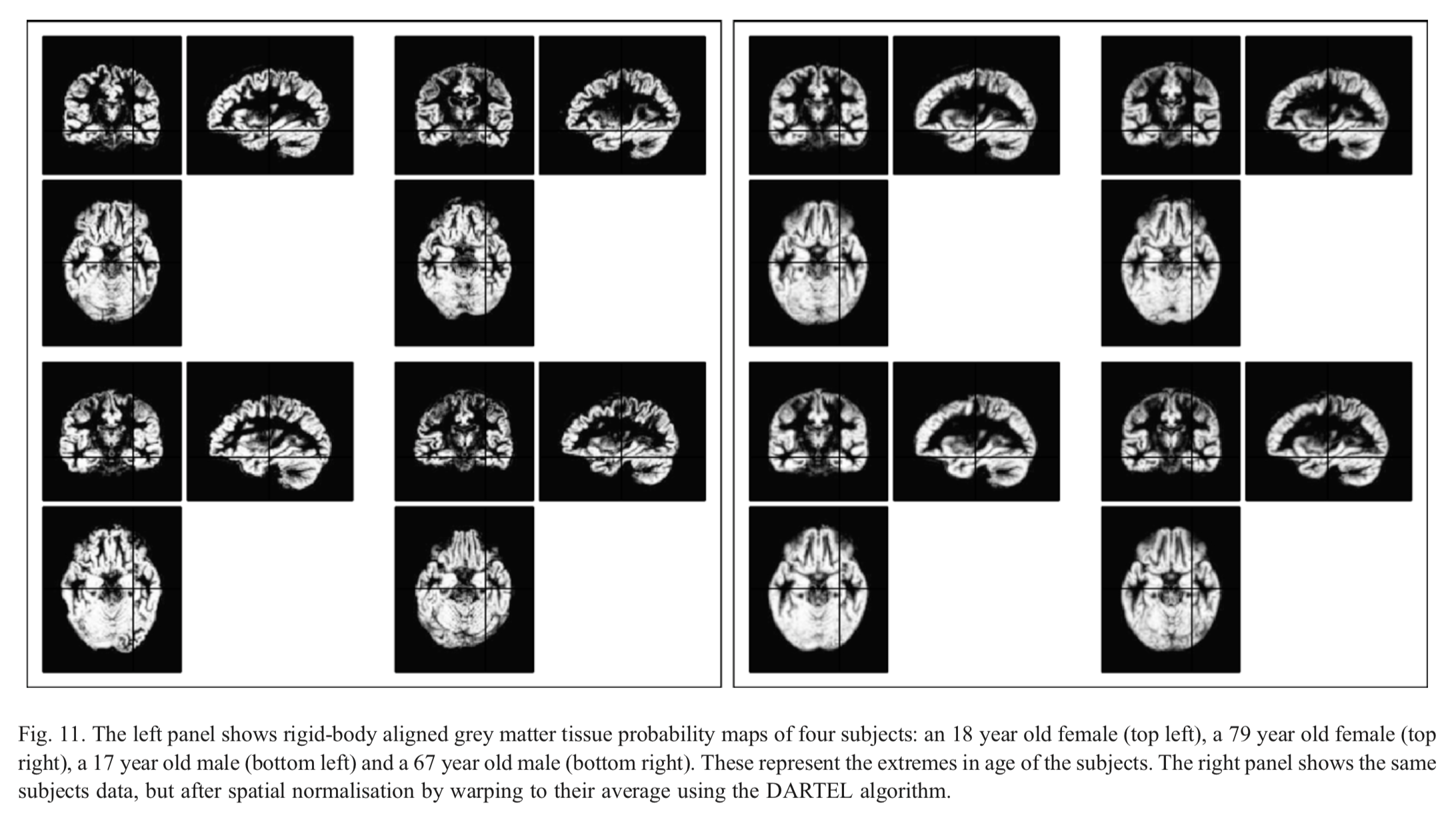 [论文笔记] A Fast diffeomorphic image registration algorithm_hellopipu的博客-CSDN博客