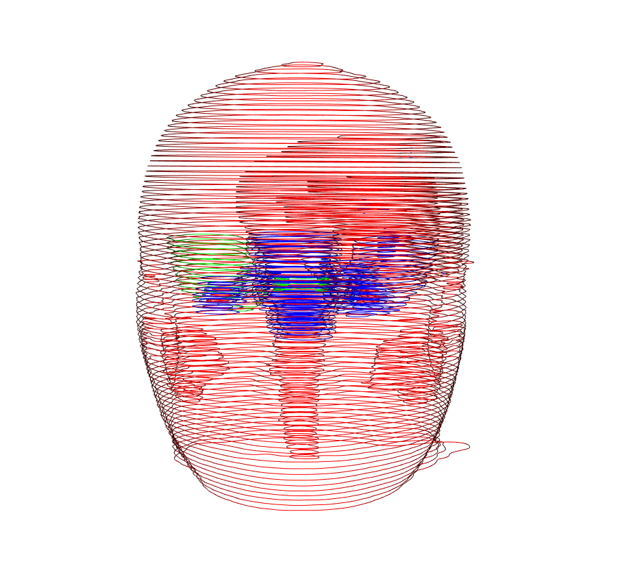 基于vtkVoxelContoursToSurfaceFilter实现勾画图像的轮廓线面重建_vtk contour切割-CSDN博客