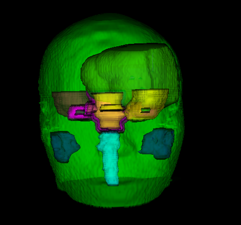 基于vtkVoxelContoursToSurfaceFilter实现勾画图像的轮廓线面重建_vtk contour切割-CSDN博客