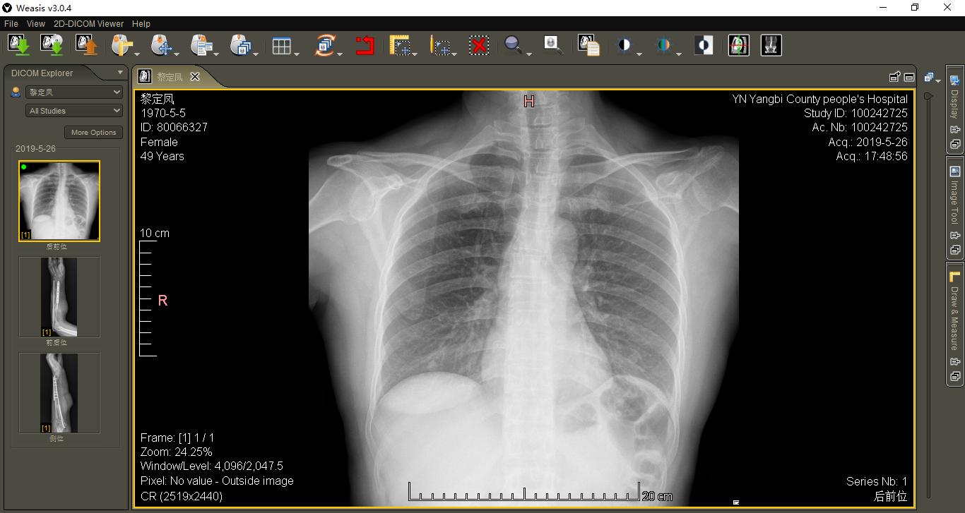 Weasis研究(一): IDEA启动运行Weasis3.0.4-CSDN博客