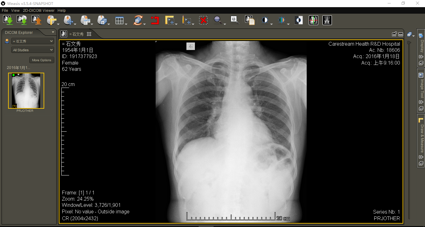 Weasis研究(二): IDEA启动运行Weasis3.5.4-CSDN博客