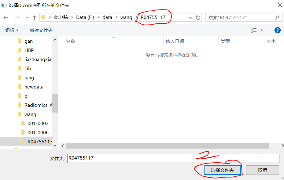 第四章 基于QT和DCMTK的Dicom 图像浏览器---检查文件夹下Dicom序列个数_dicom序列文件数量-CSDN博客
