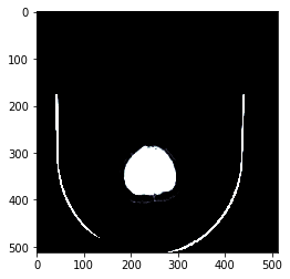 CT流程与CT图像的windowing操作(转载＋整理)_ct 图像处理 brain window subdural window bone ...