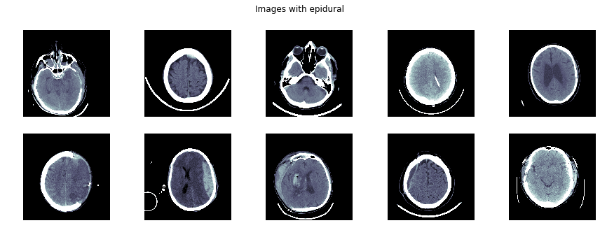 CT流程与CT图像的windowing操作(转载＋整理)_ct 图像处理 brain window subdural window bone ...