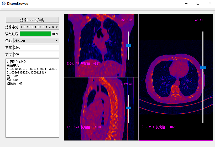 基于QT和DCMTK的Dicom 图像浏览器---收尾二_开源dicom 浏览器-CSDN博客