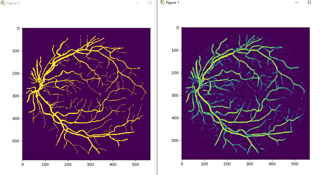 5 líneas de código Python para lograr la segmentación de imágenes ...