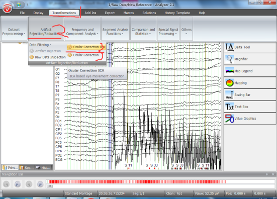 BP_Analyzer_完整笔记_bp analyzer-CSDN博客