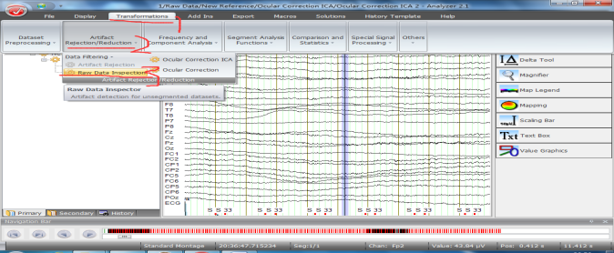 BP_Analyzer_完整笔记_bp analyzer-CSDN博客