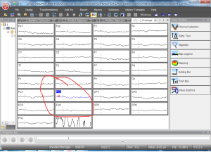 BP_Analyzer_完整笔记_bp analyzer-CSDN博客