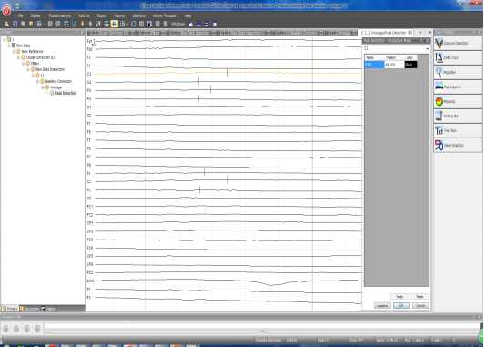 BP_Analyzer_完整笔记_bp analyzer-CSDN博客