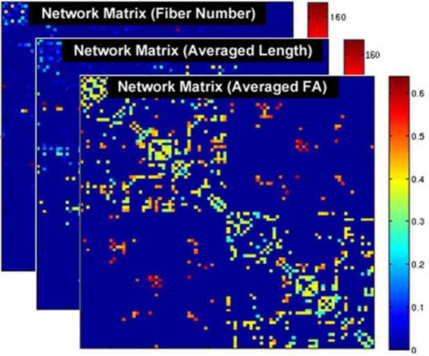 DTI脑网络构建 详细介绍处理过程以及PANDA的使用_dti 图论-CSDN博客