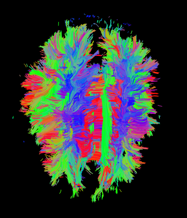 DTI脑网络构建 详细介绍处理过程以及PANDA的使用_dti 图论-CSDN博客