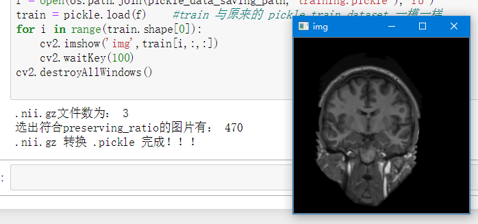 .nii.gz 图片文件的读取_vs2019如何读取nii。gz-CSDN博客