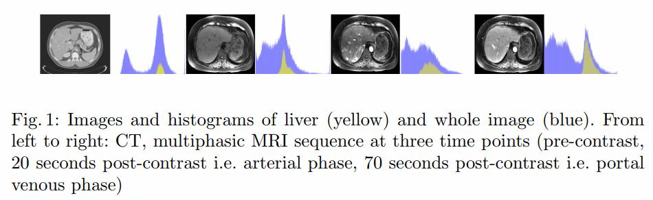 Unsupervised Domain Adaptation via Disentangled Representations: Application to Cross-Modality ...