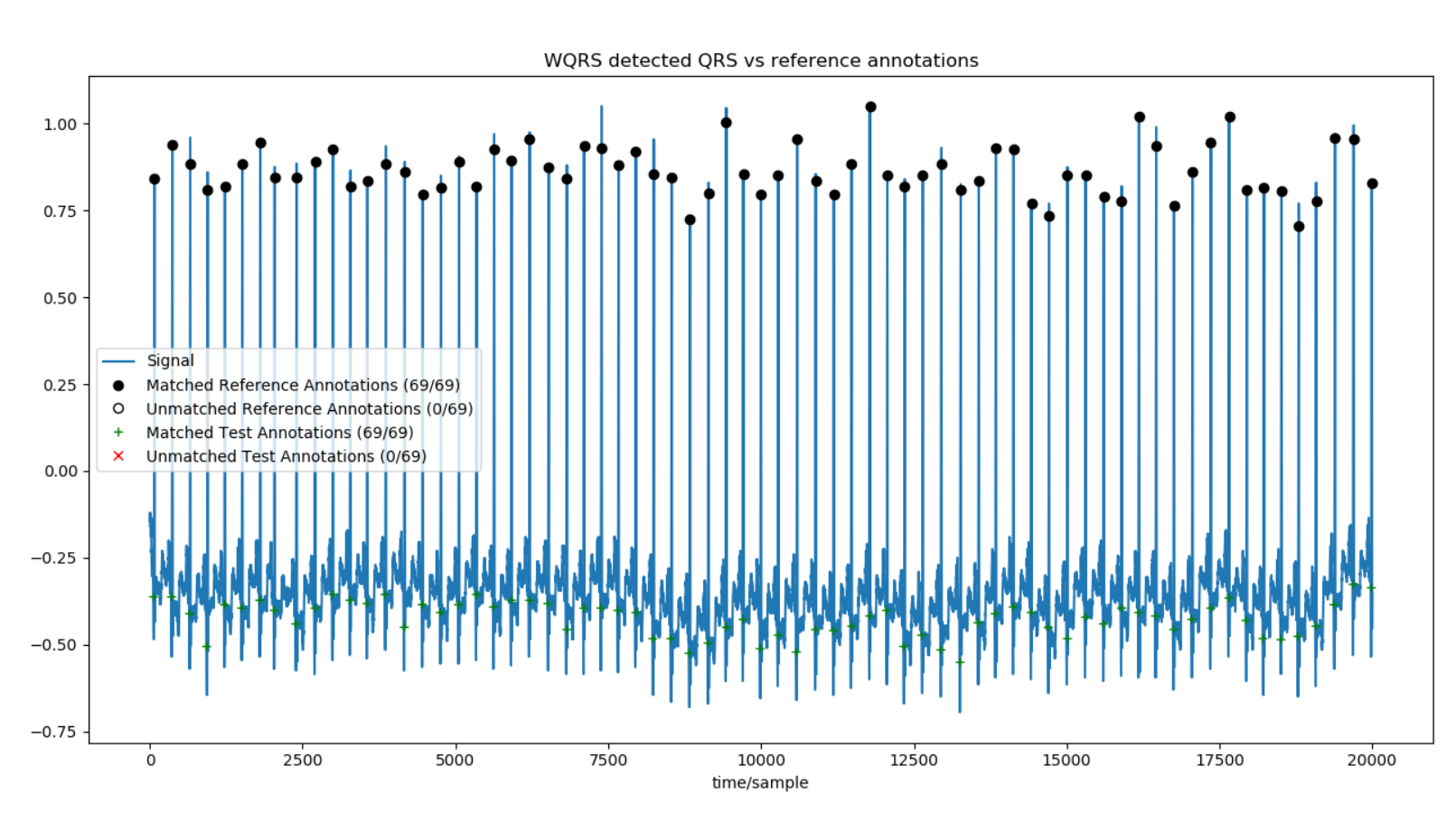 在python项目中调用Physionet上的WFDB算法包（c语言版）_wfdb c-CSDN博客