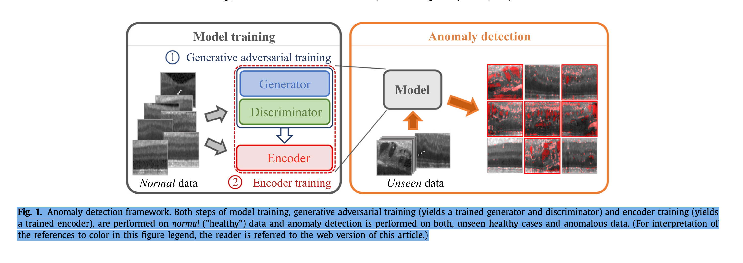 深度学习论文笔记（异常检测）——f-AnoGAN: Fast unsupervised anomaly detection with generative adversarial ...