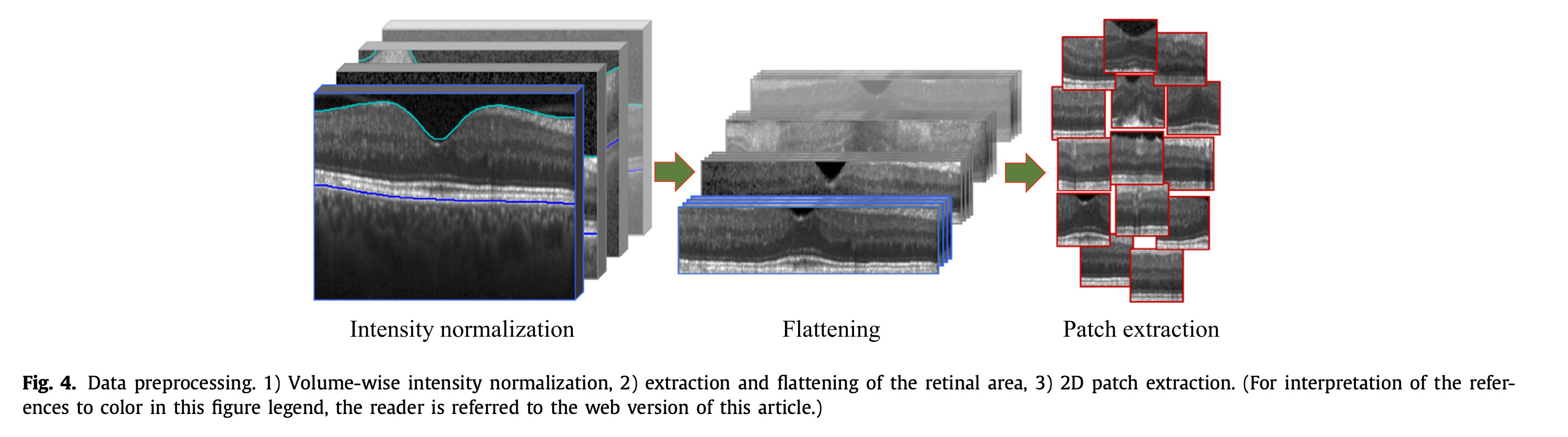 深度学习论文笔记（异常检测）——f-AnoGAN: Fast unsupervised anomaly detection with generative adversarial ...